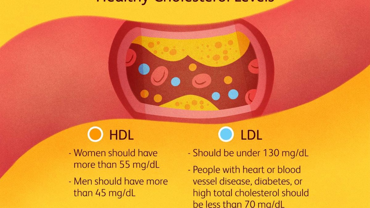 Cum creștem nivelul HDL - colesterolul bun? - Cardiologie Deva Dr ...